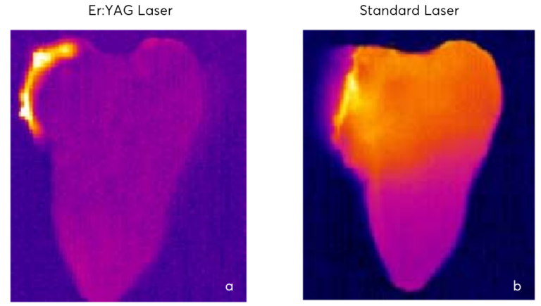 Laser + Holistic Dental - A unique, science based approach to dentistry